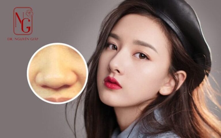Surgery Collecting the Wings of the Nose - Turn The Nose Becomes Slim ...